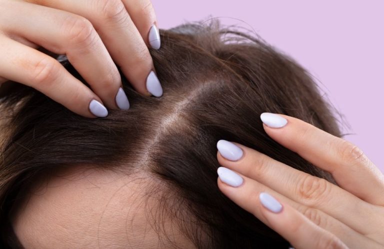 13 Natural DHT Blocker Foods That May Stop Hair Loss